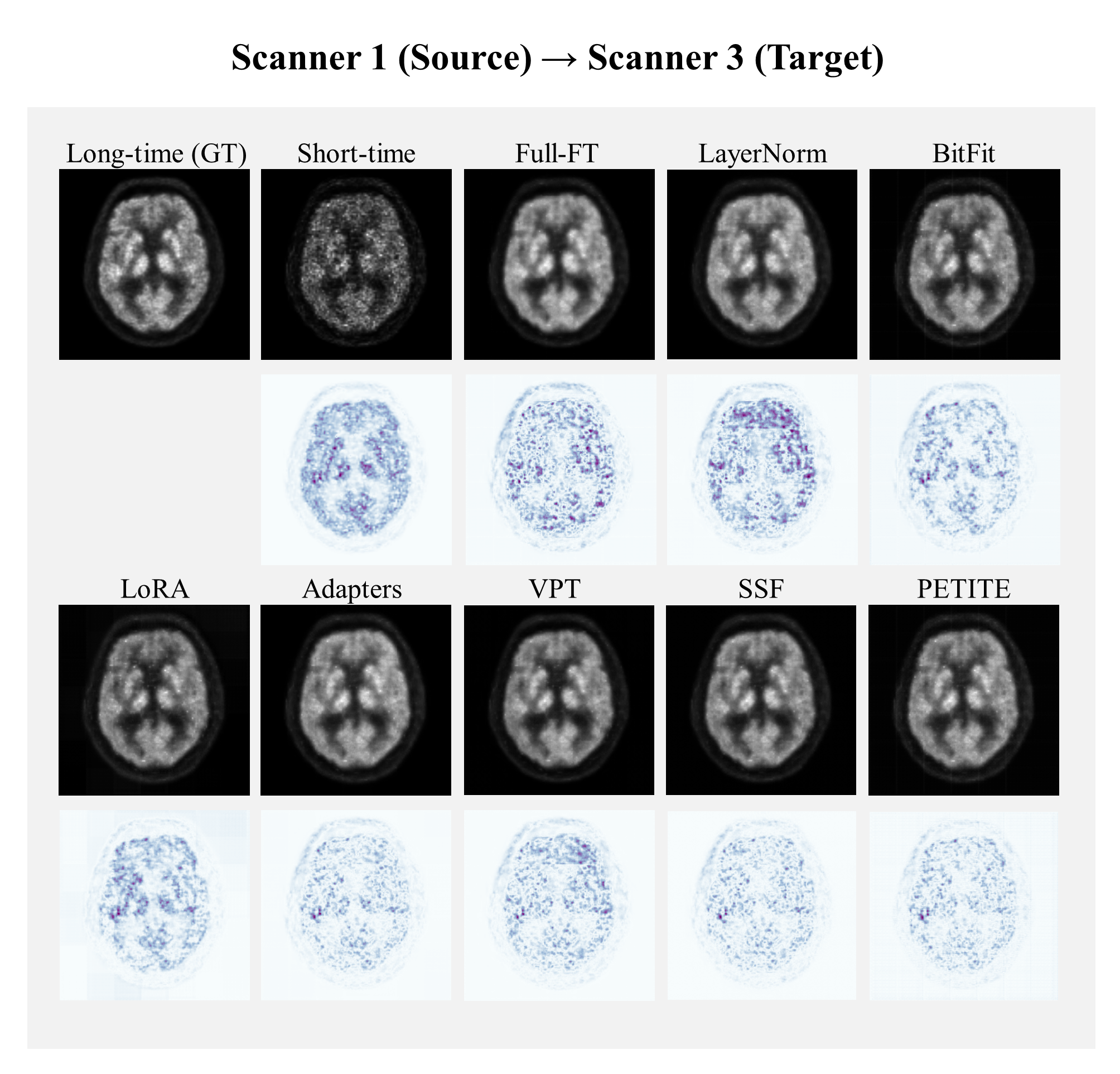 PETITE: Parameter Efficient Fine Tuning for Multi-scanner PET to PET ...